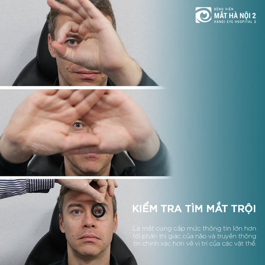 Cách kiểm tra tìm mắt trội | Sức Khỏe Cộng Đồng